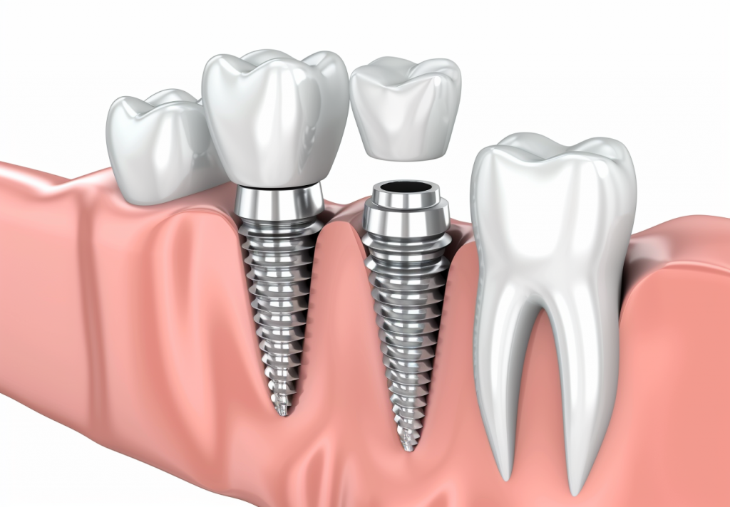 Biocompatible Coatings: Advancements in Medical Implants and Devices
